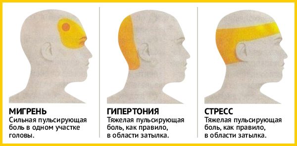 The pressure on the temples is normal: at home, medications ...